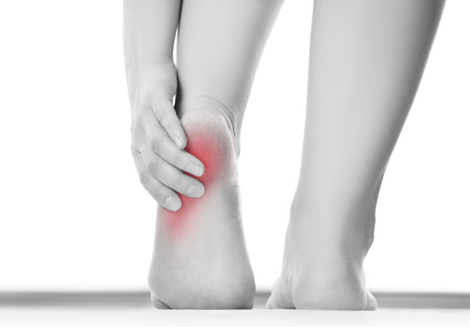 Pijn in de kuit | Oosterbaan Alkmaar